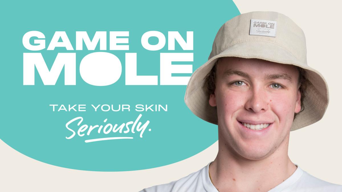 Game On Mole is back this summer | Melanoma Institute Australia